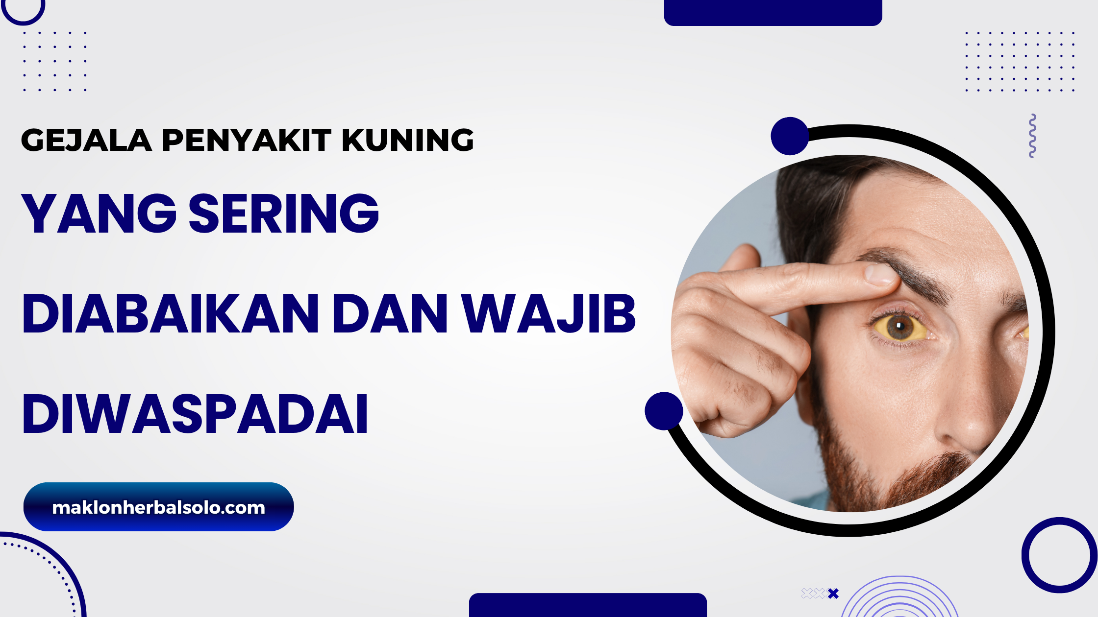 Gejala Penyakit Kuning yang Sering Diabaikan