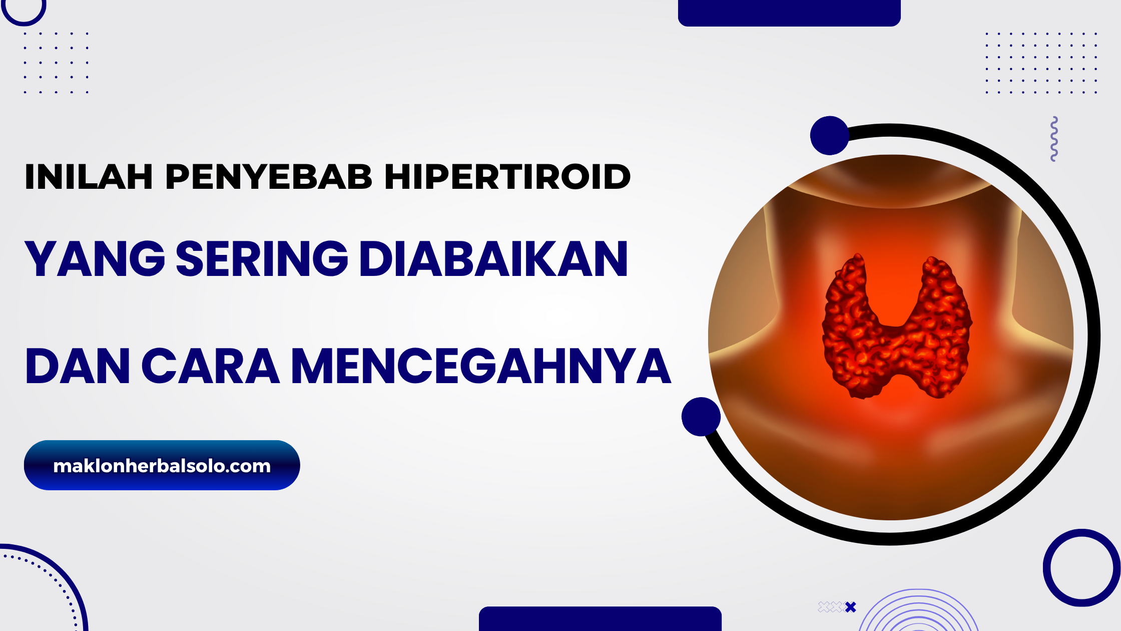 Inilah Penyebab Hipertiroid yang Sering Diabaikan
